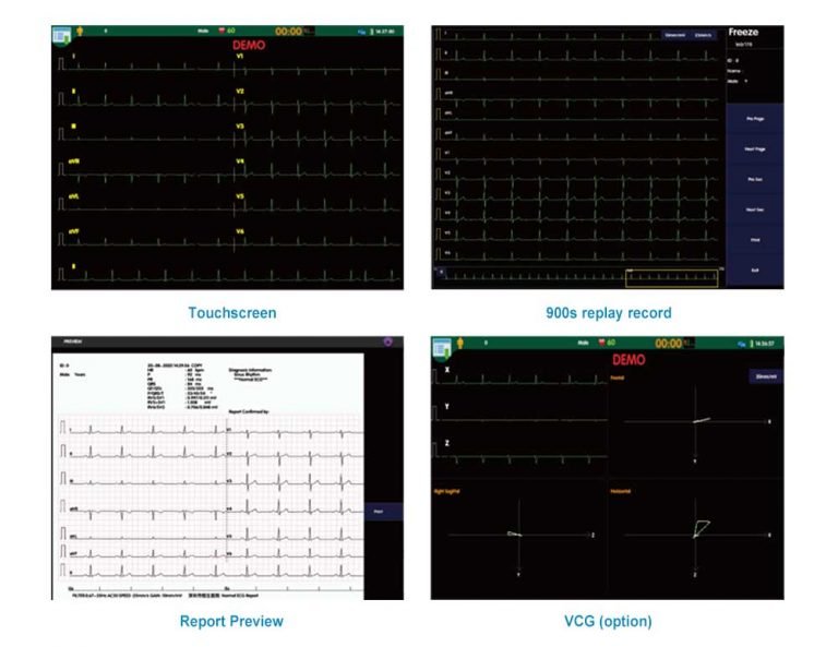 Digital ECG Machine - e1200/e1200plus - PROMED